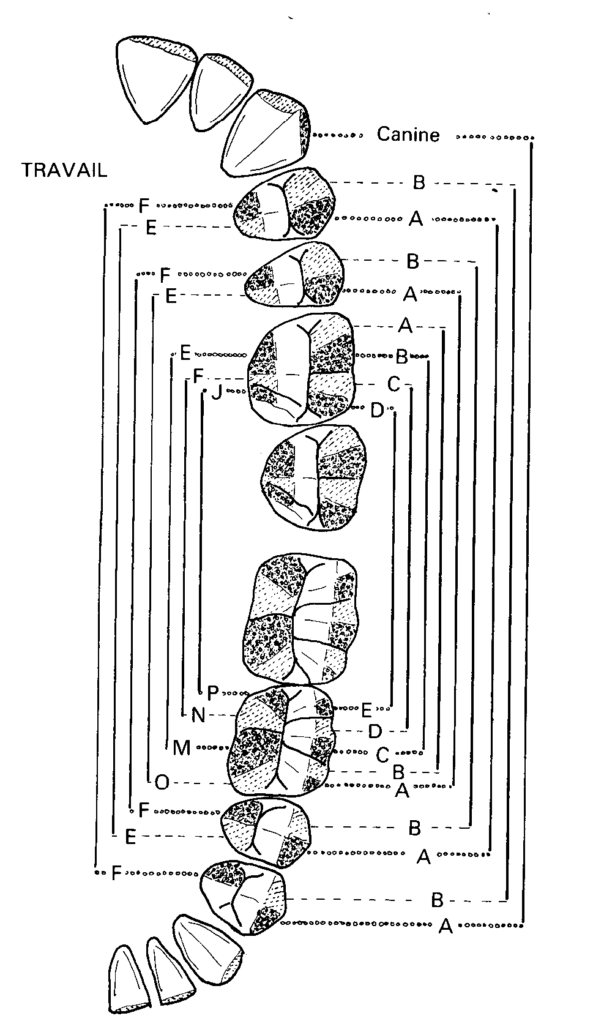 Réhabilitation neuro occlusive ou technique de Planas | eorthodontie