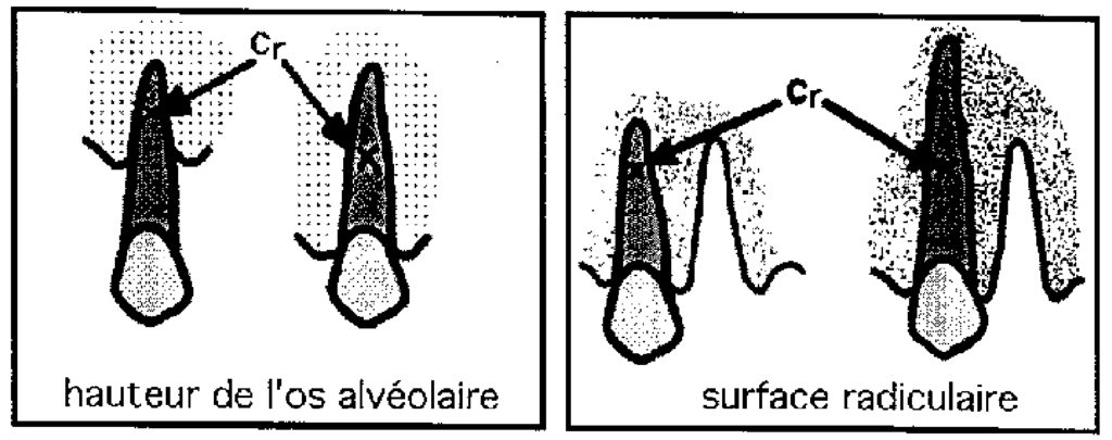 La biomécanique | eorthodontie
